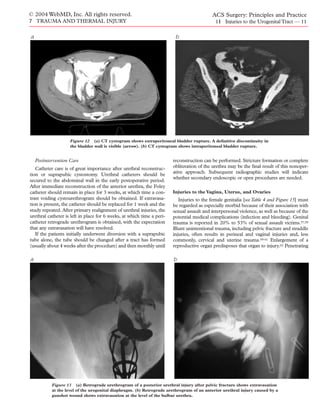 Acs0711 Injuries To The Urogenital Tract | PDF