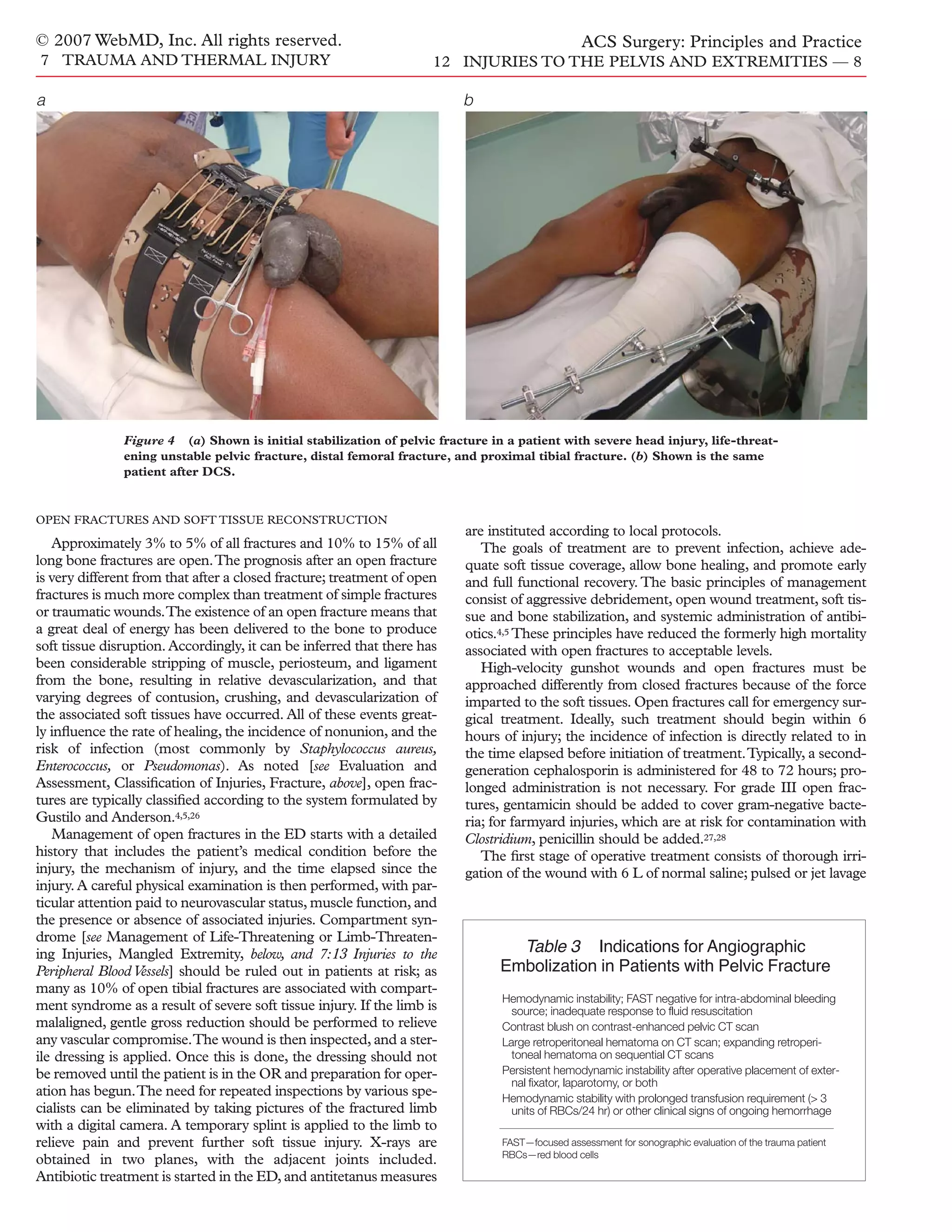Acs0712 Injuries To The Pelvis And Extremities | PDF