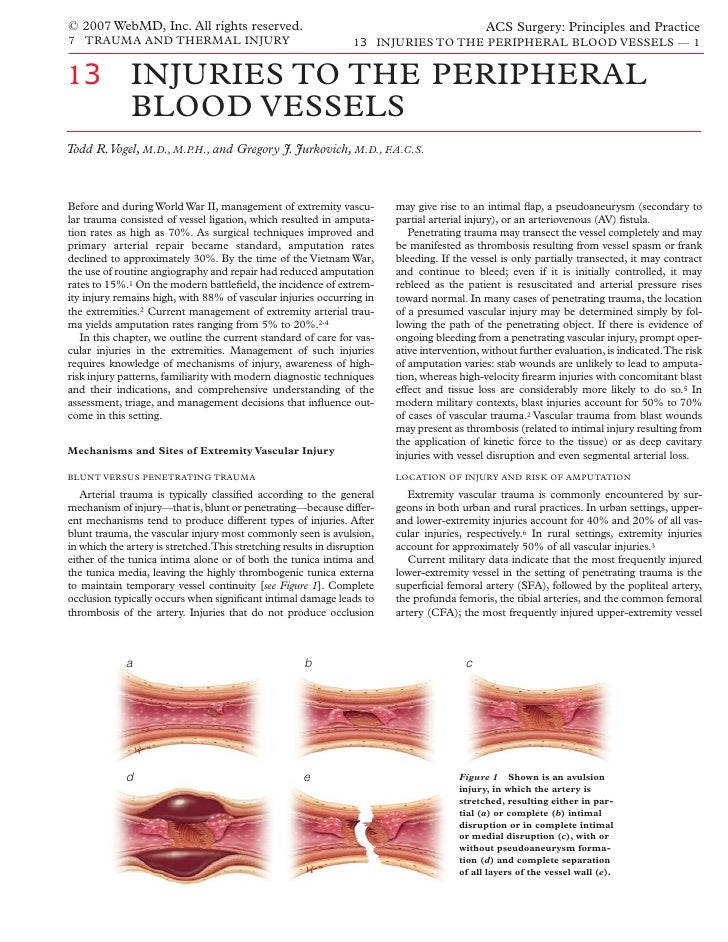 Acs0713 Injuries To The Peripheral Blood Vessels