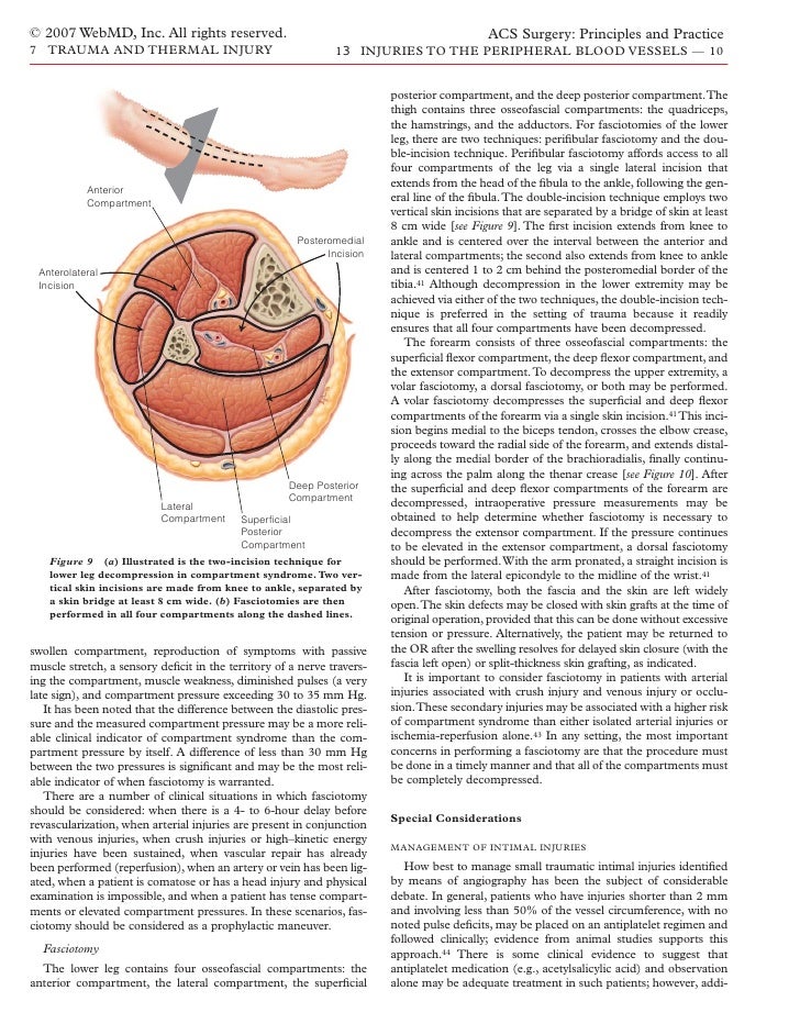 Acs0713 Injuries To The Peripheral Blood Vessels