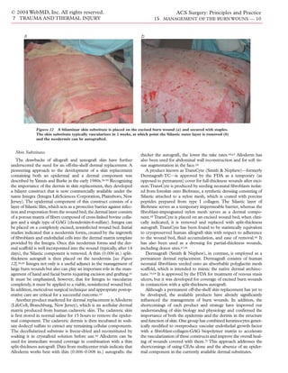 Acs0715 Management Of The Burn Wound | PDF | Skin and Dermatology ...