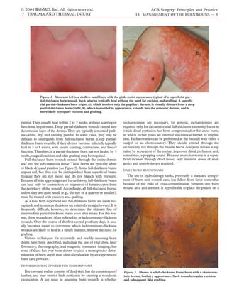 Acs0715 Management Of The Burn Wound | PDF | Skin and Dermatology ...