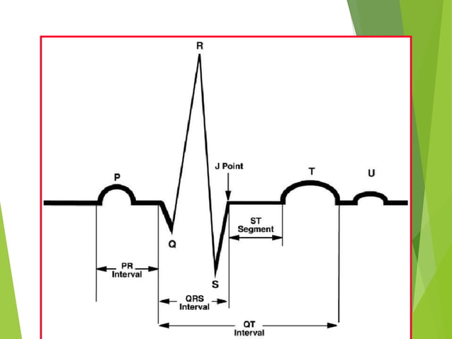 ACS ALGORITHYME STEMI.pptx
