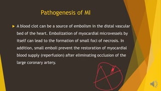 Acute coronary syndrome and myocardial infarction | PDF