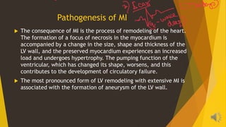 Acute coronary syndrome and myocardial infarction | PDF