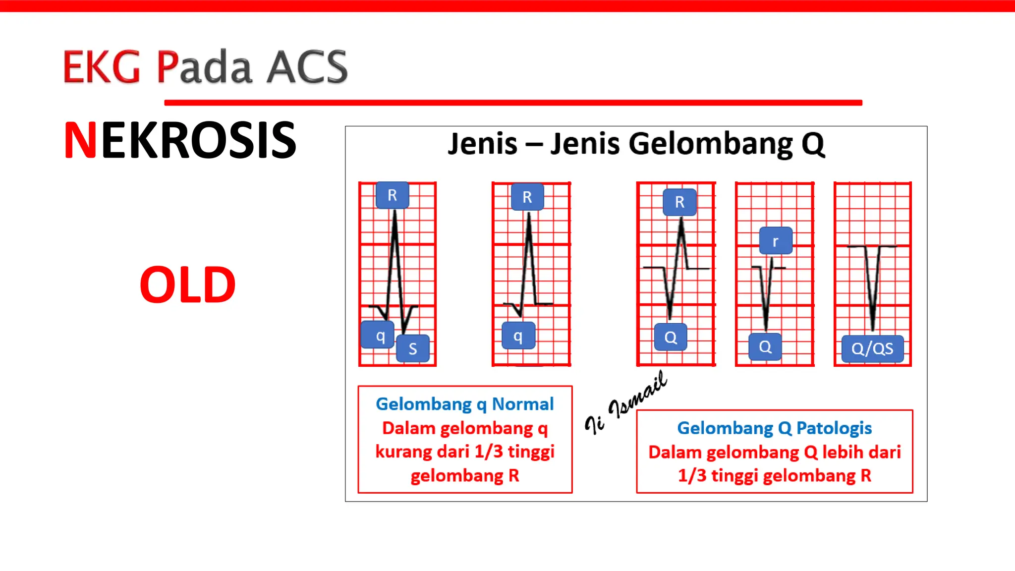 ACS Code Blue [Autosaved].pptx