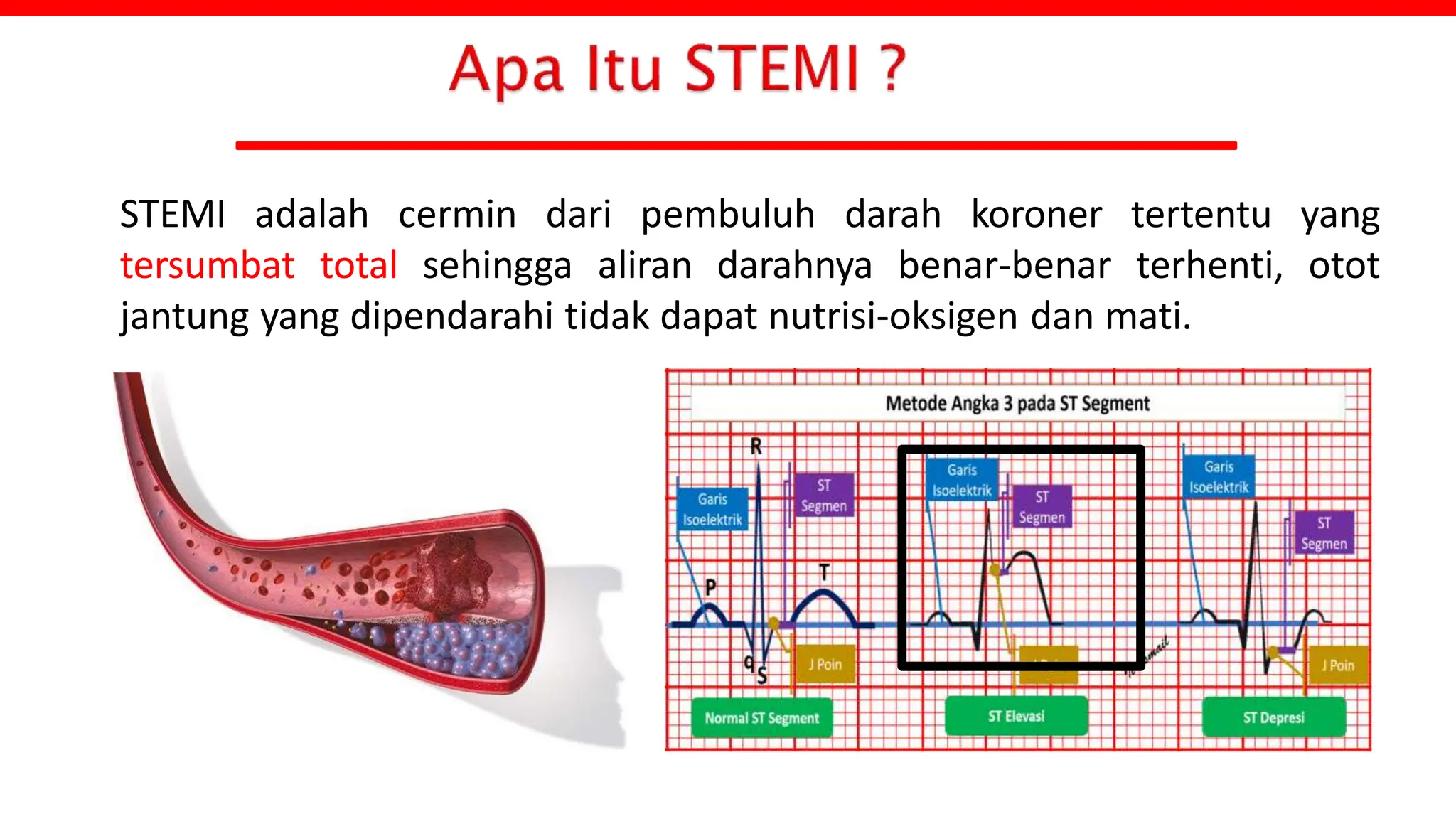 ACS Code Blue [Autosaved].pptx
