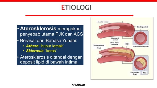 ACS Code Blue [Autosaved].pptx
