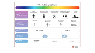 dr.Personaldi, ESC guideline ACS esc Naldi.pptx