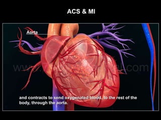 Heart Attack (Acs & mi) | PPT | Free Download