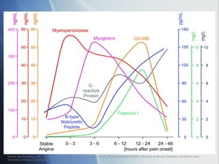 Acs – new biomarkers & role of newer anticoagulants | PPT