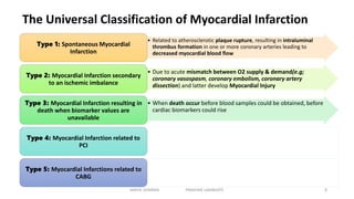 Acute Coronary Syndrome | PPTX