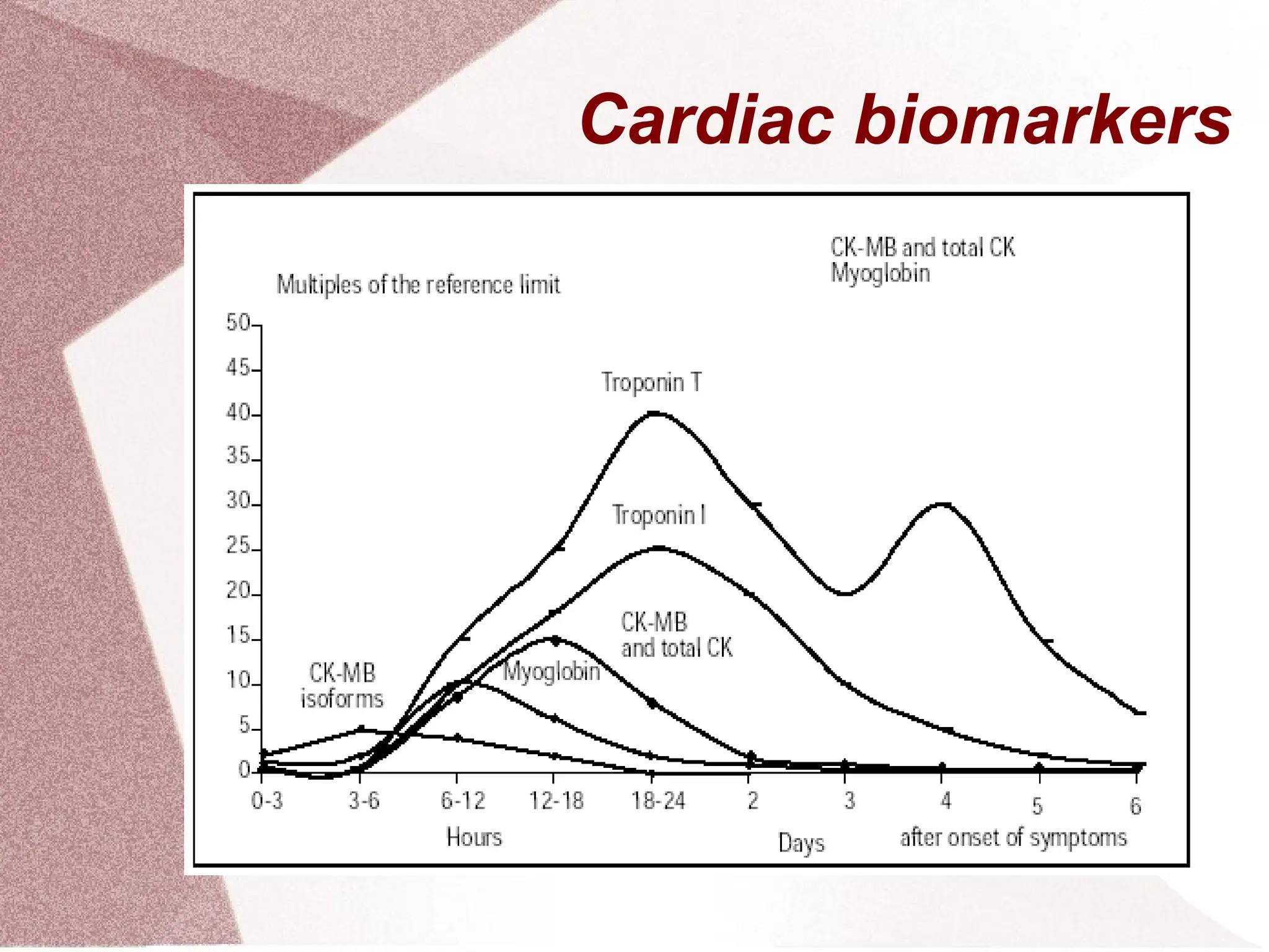 Acute Coronary Syndrome presentation.ppt