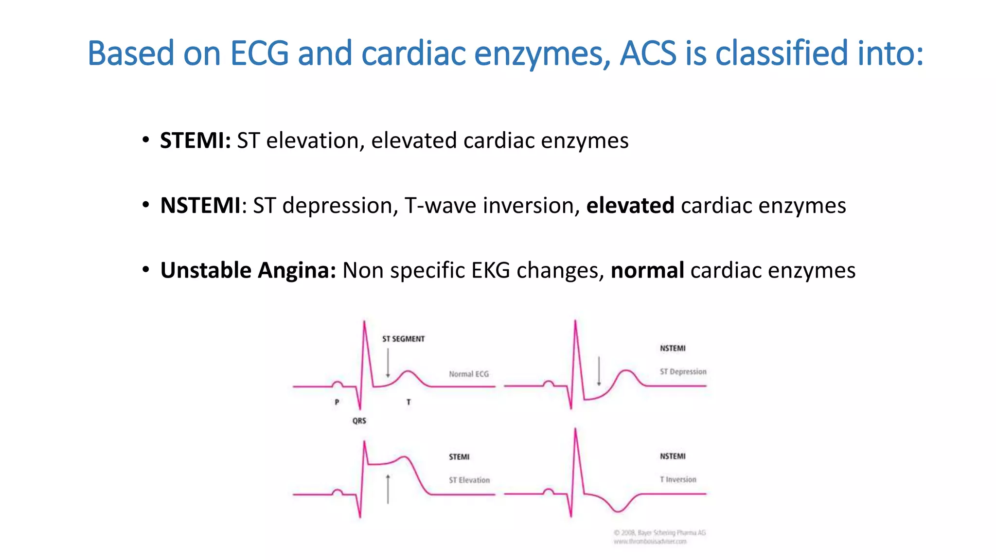 Acute Coronary Syndrome - Overview | PPTX
