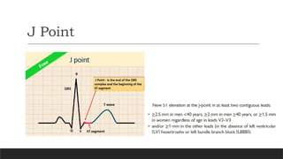 ACS STEMI acute ST-segment elevation myocardial infarction (STEMI ...