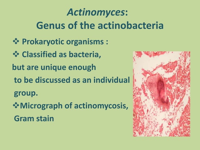 Actinomyces | PPTX | Biological Sciences | Science