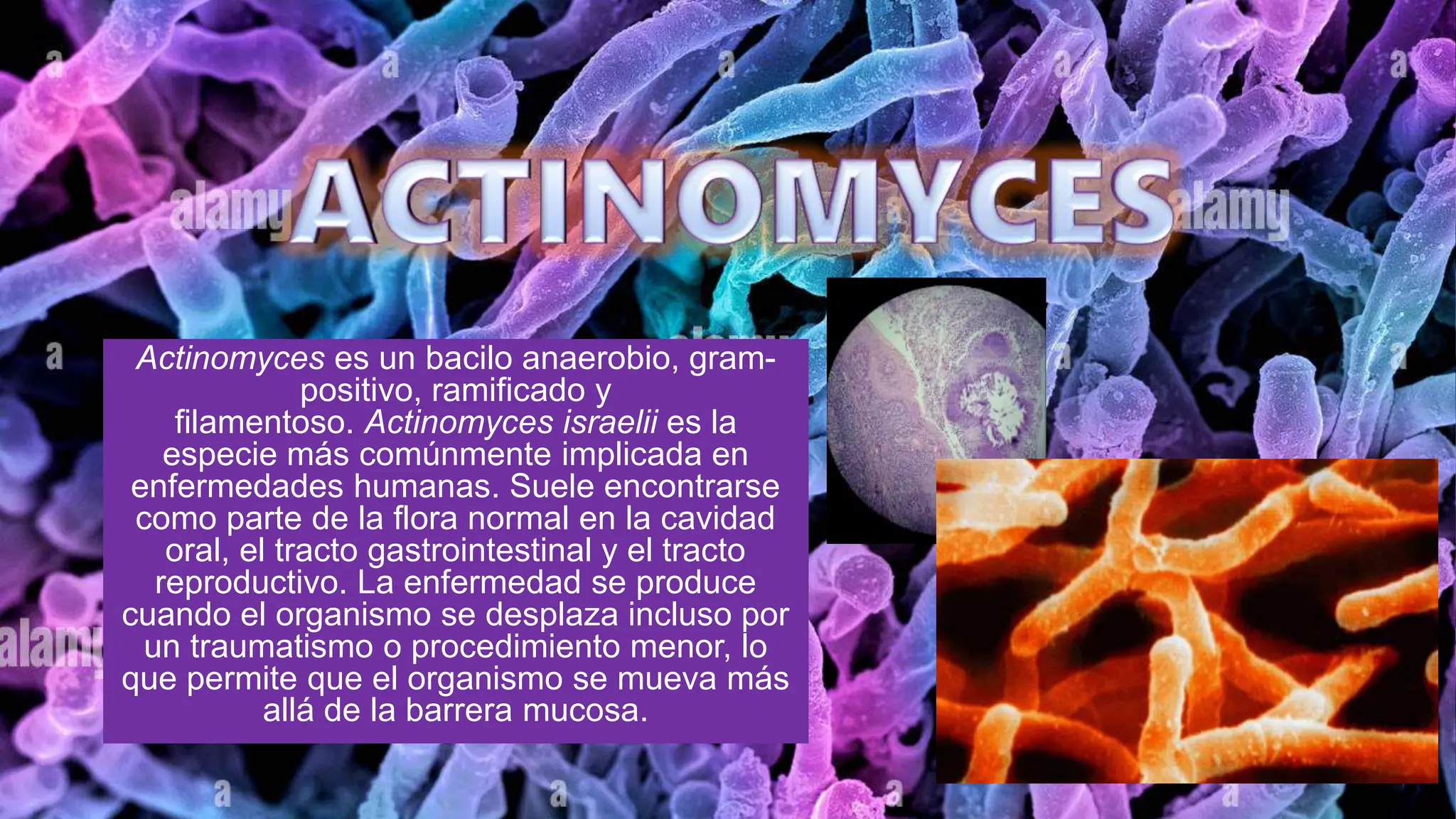 ACTINOMYCES CONCEPTO TIPOS CARACTERISTICAS | PPTX