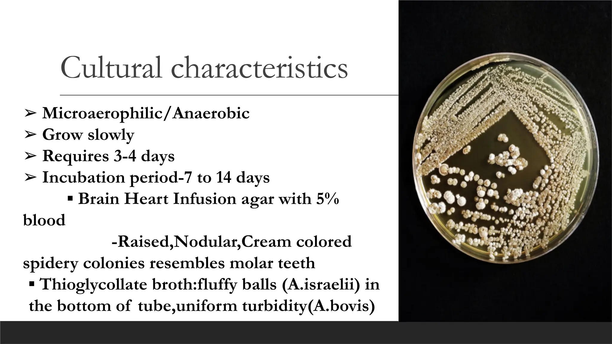 actinomyces for bachelor of dental surgery. pptx | PPTX