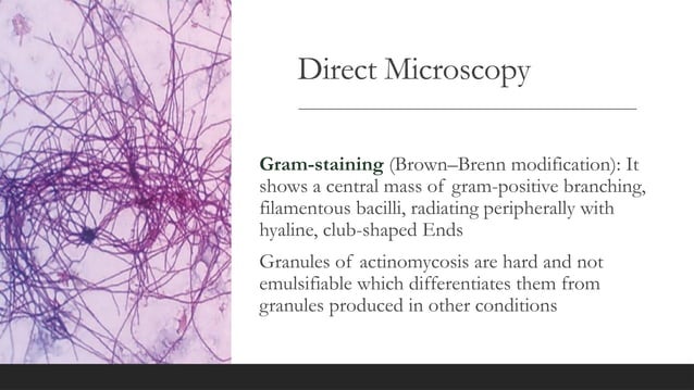 Actinomyces For Bachelor Of Dental Surgery Pptx Ppt