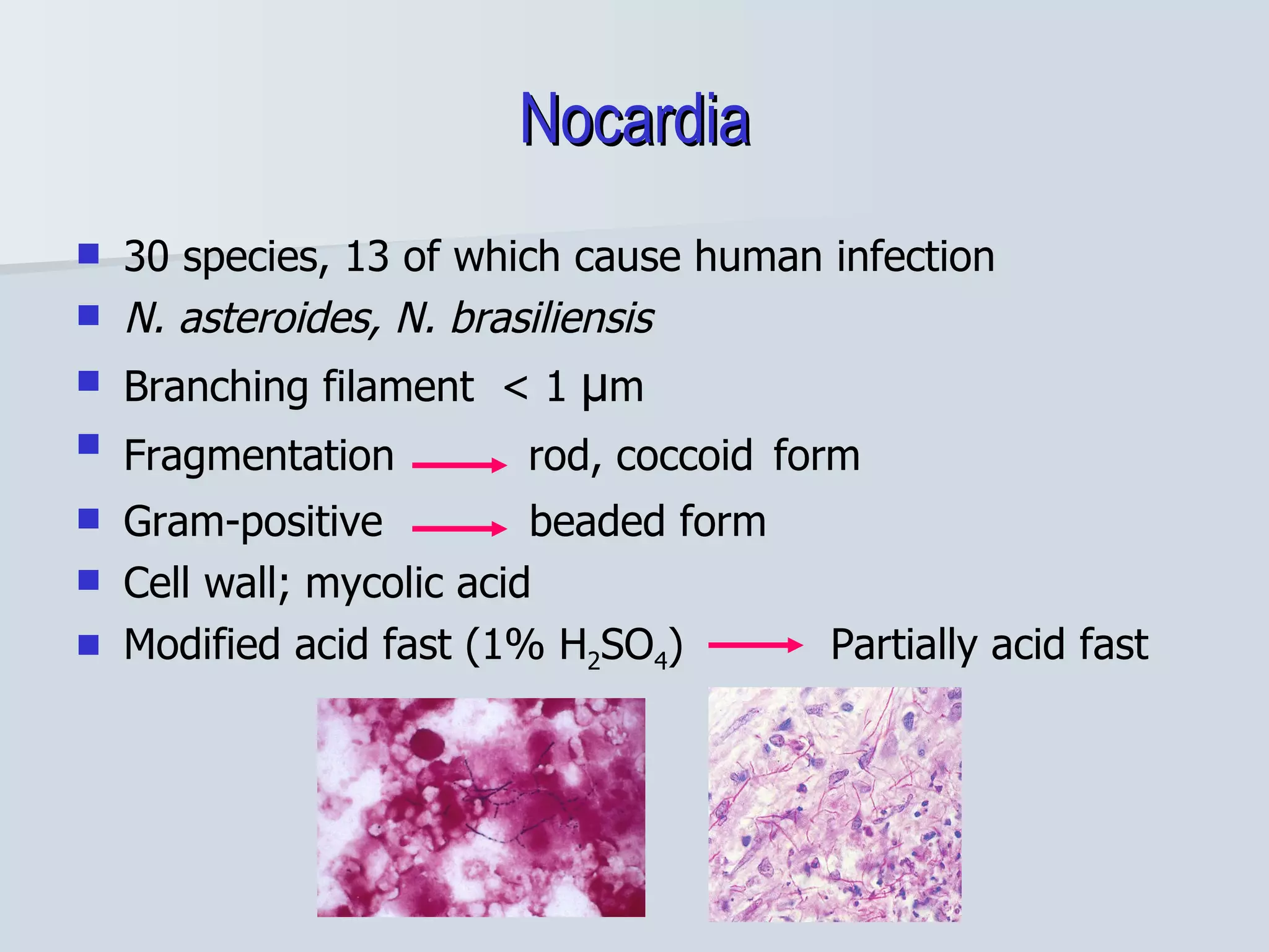 Actinomyces + nocardia | PPT