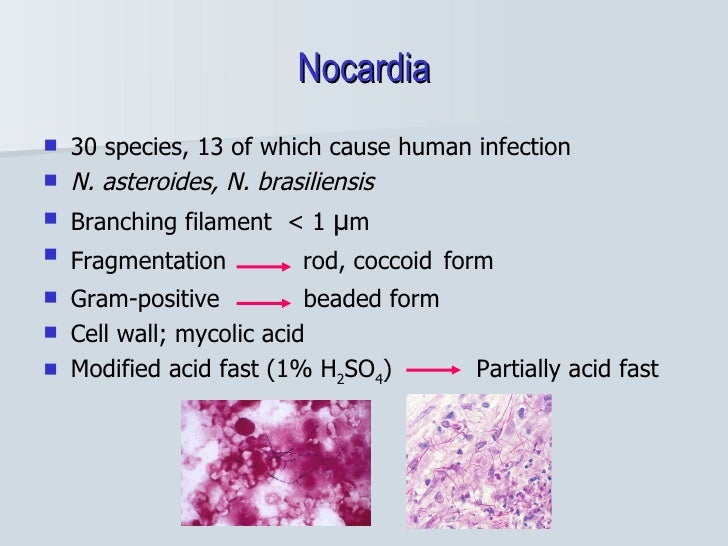 Actinomyces + nocardia