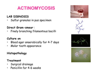 Actinomyces & nocardia | PDF