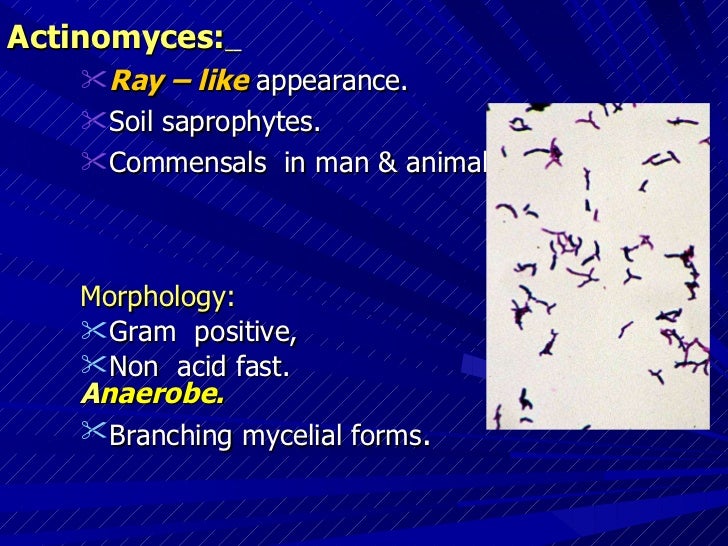 Actinomycetales