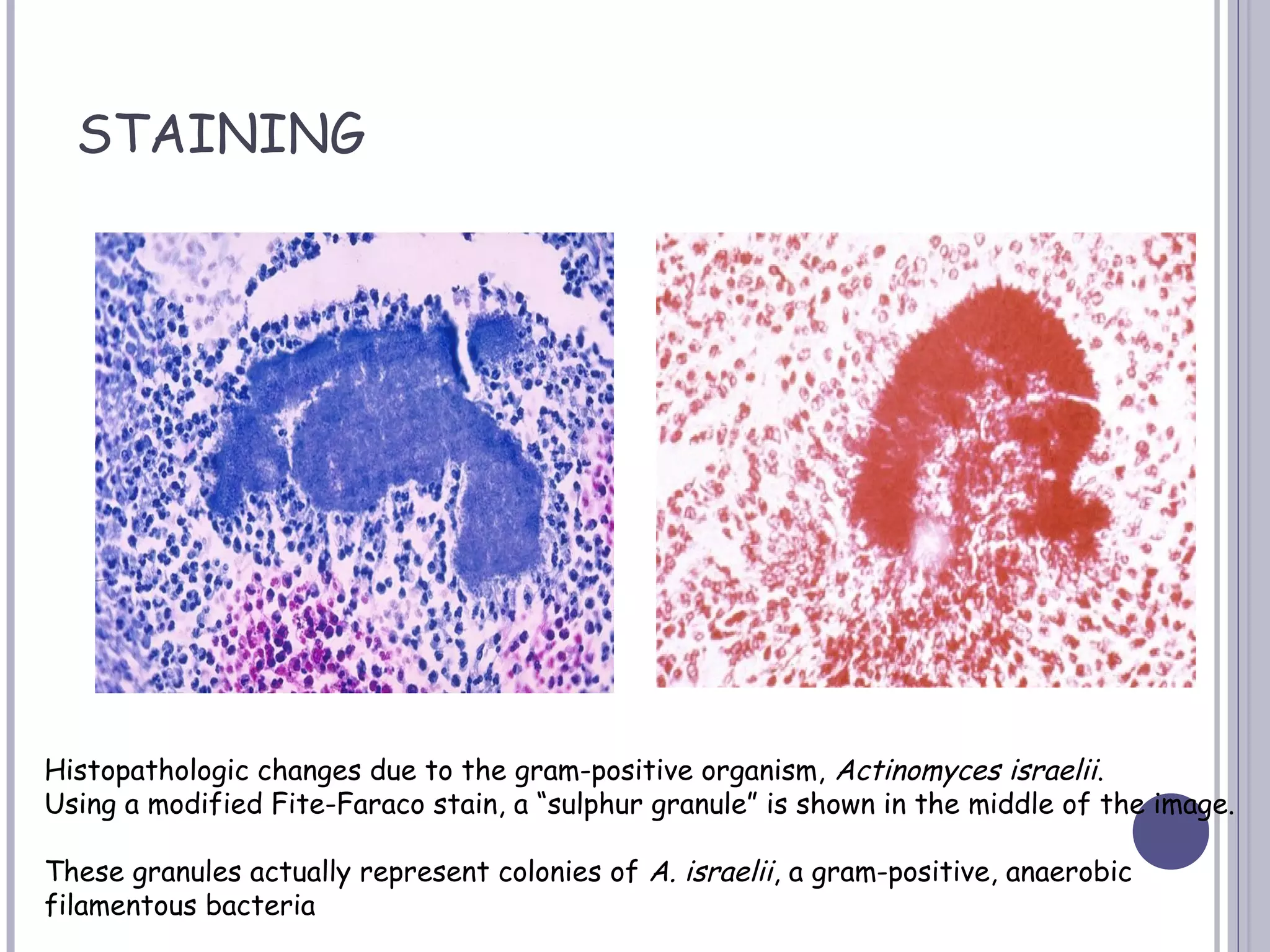 Actinomycetes | PPT | Ear, Nose and Throat Conditions | Diseases and ...