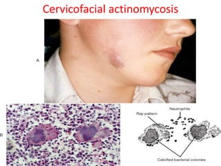 Actinomycetes | PPTX
