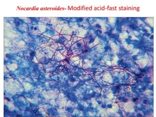 Actinomycetes | PPTX