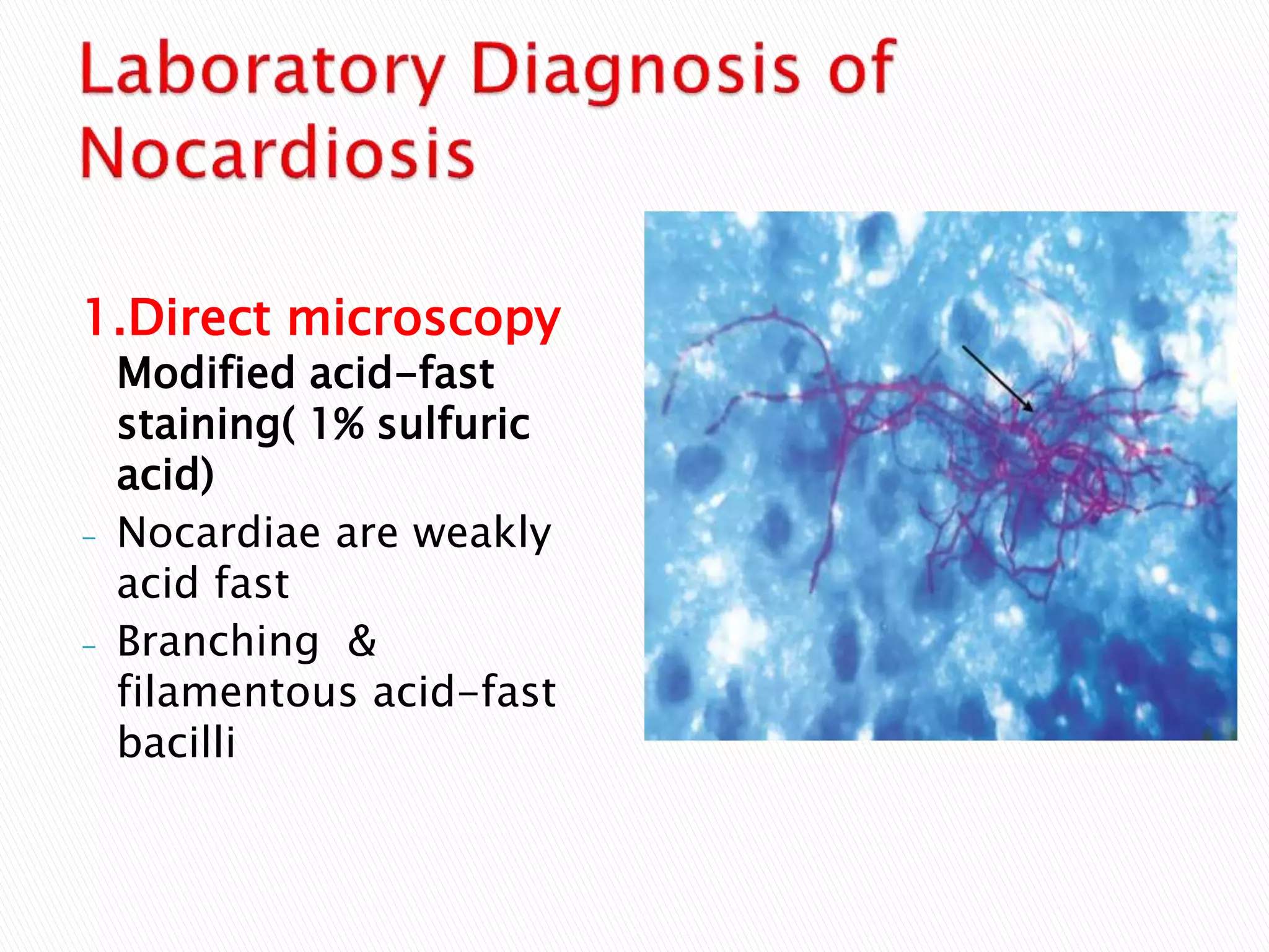 Actinomycetes and Nocardia | PPTX