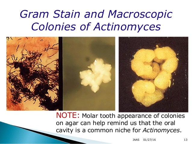 Actinomycosis & Norcardiosis