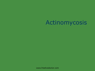 Actinomycosis | PPT