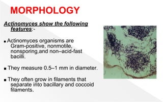 Actinomycosis | PDF