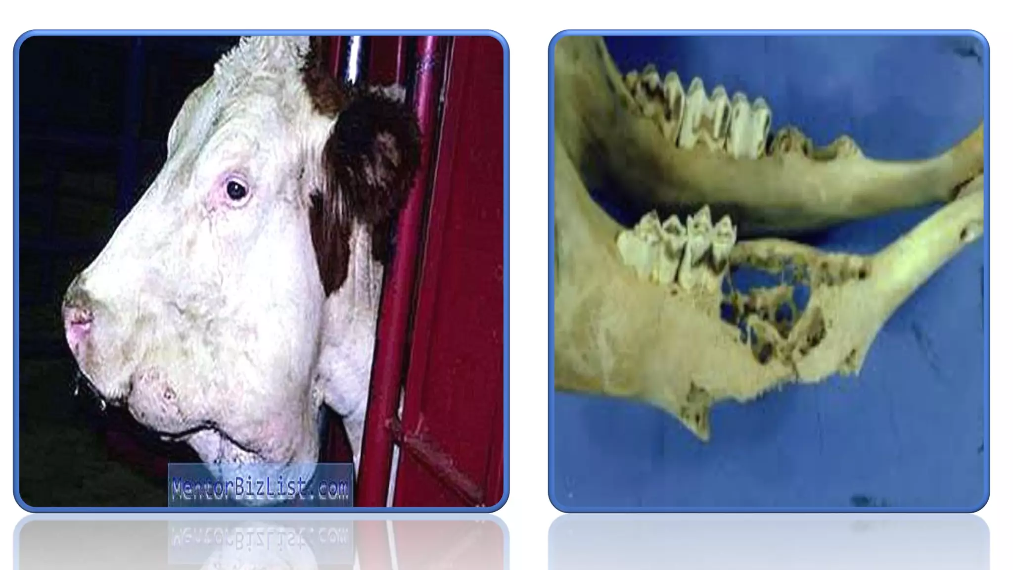 Actinomycosis (Lumpy Jaw) | PDF