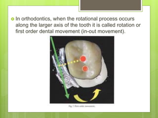 Action and reaction in orthodontics | PPTX