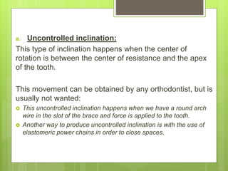 Action and reaction in orthodontics | PPTX