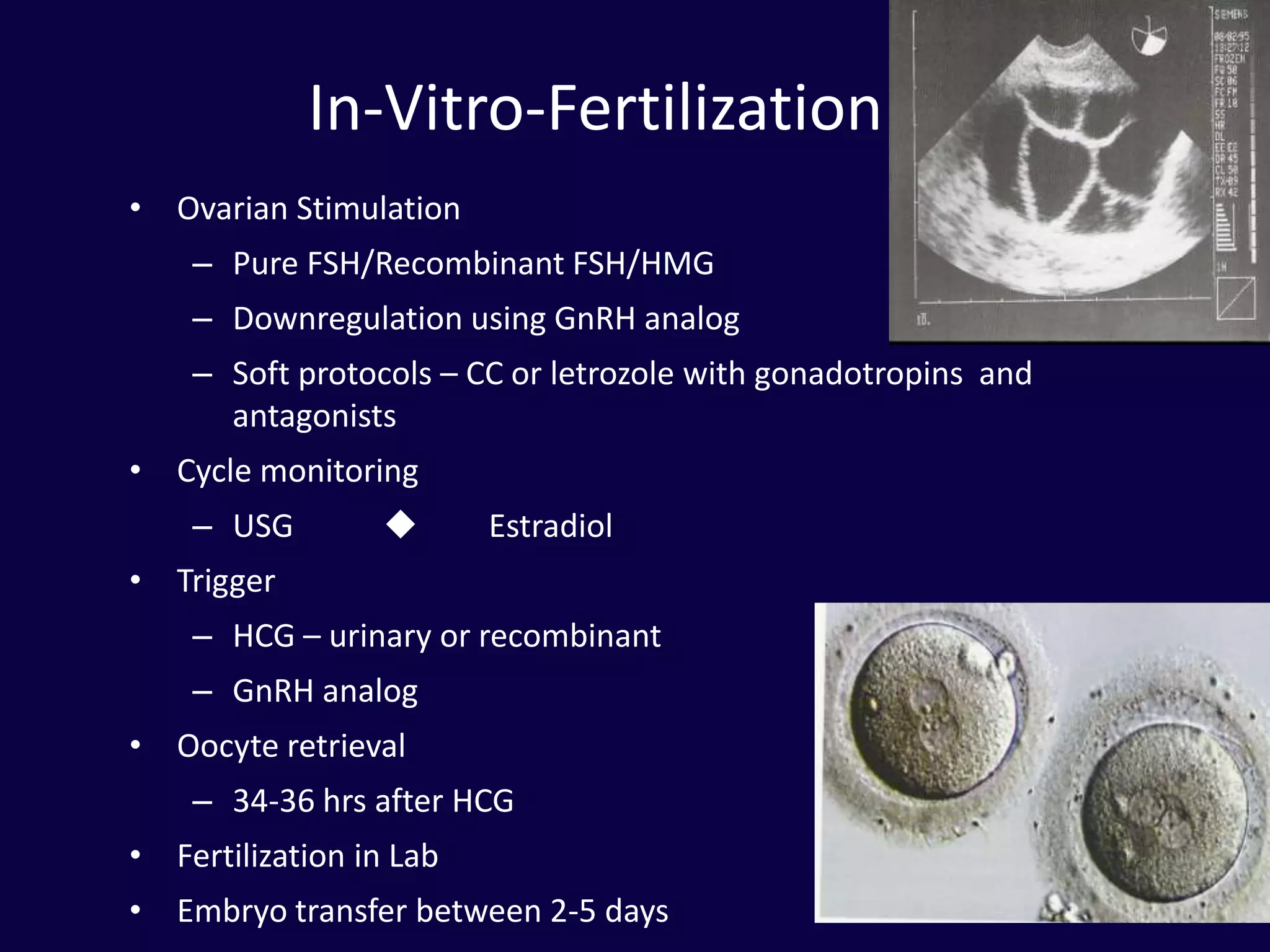 Mangment of Infertility | PPTX