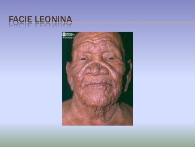 Actitud, decúbitos, posturas, marchas, facies 2014