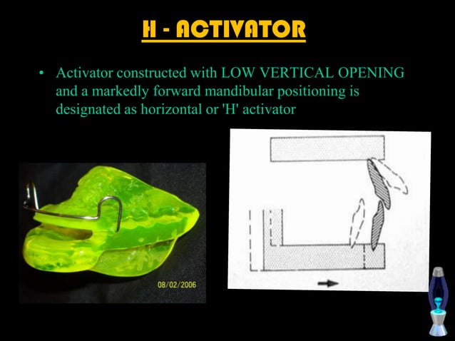 Activator and its modifications | PPTX