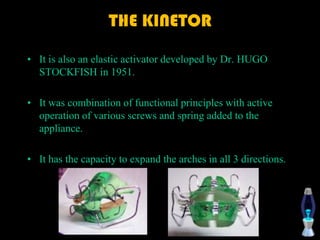 Activator and its modifications | PPTX