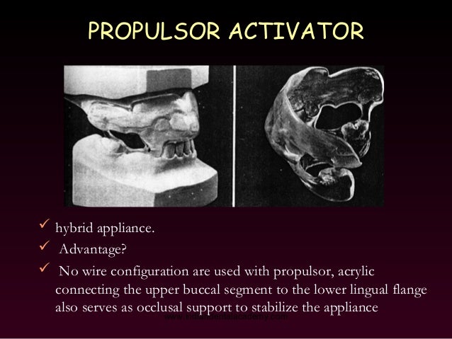 Activator and its modifications /certified fixed orthodontic courses