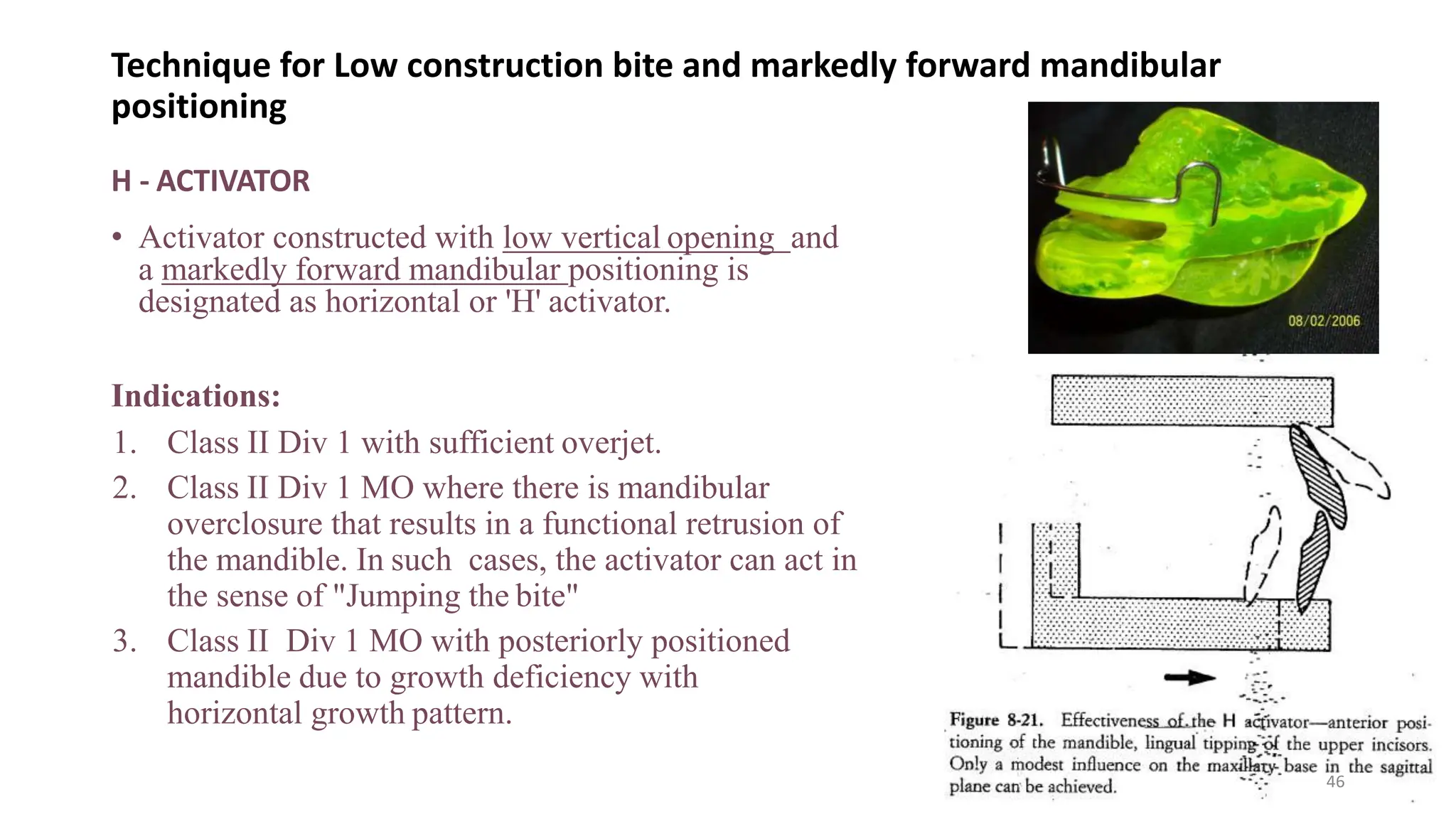 Activator- A Functional Appliance. pptx | PPTX