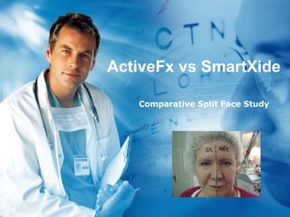 Active Fx Vs Smart Xide | PPT