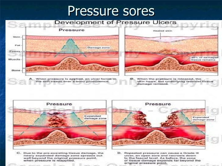 Activity And Exercise