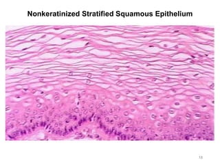 Nonkeratinized Stratified Squamous Epithelium Labeled