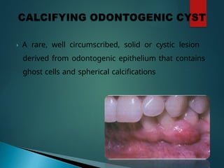 activity pathology (odontogenic cysts).pptx