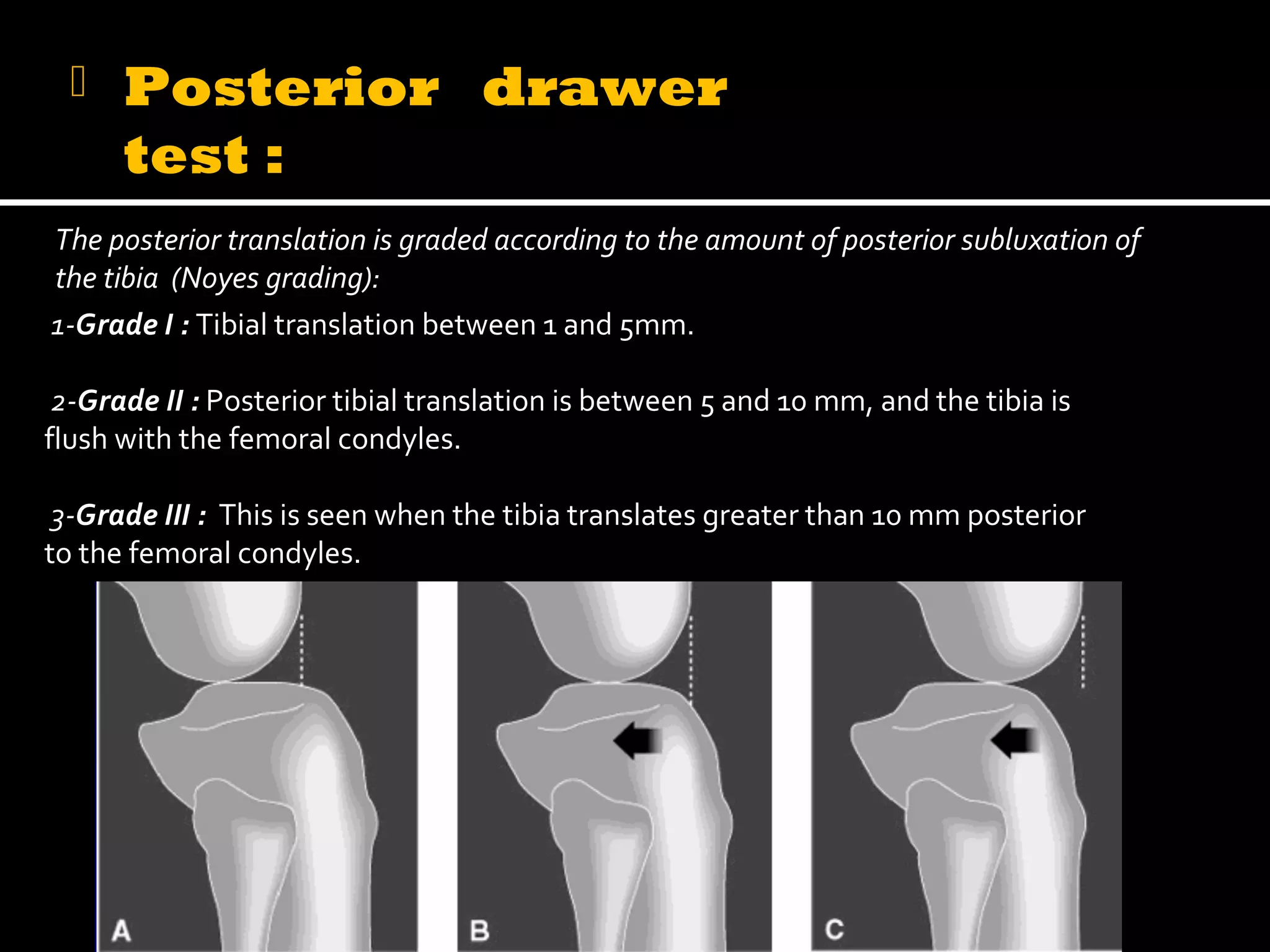 KNEE INJURIES | PPT