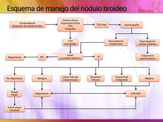 Actuación en el paciente con nódulo tiroideo | PDF