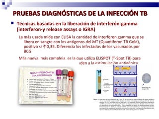 Actualización en tuberculosis | PPT